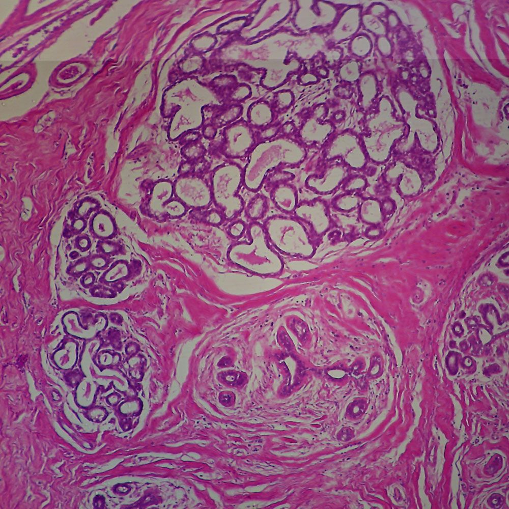 Prepared Microscope Slide, Human Breast, Mammary Gland, Lactating, H&E ...