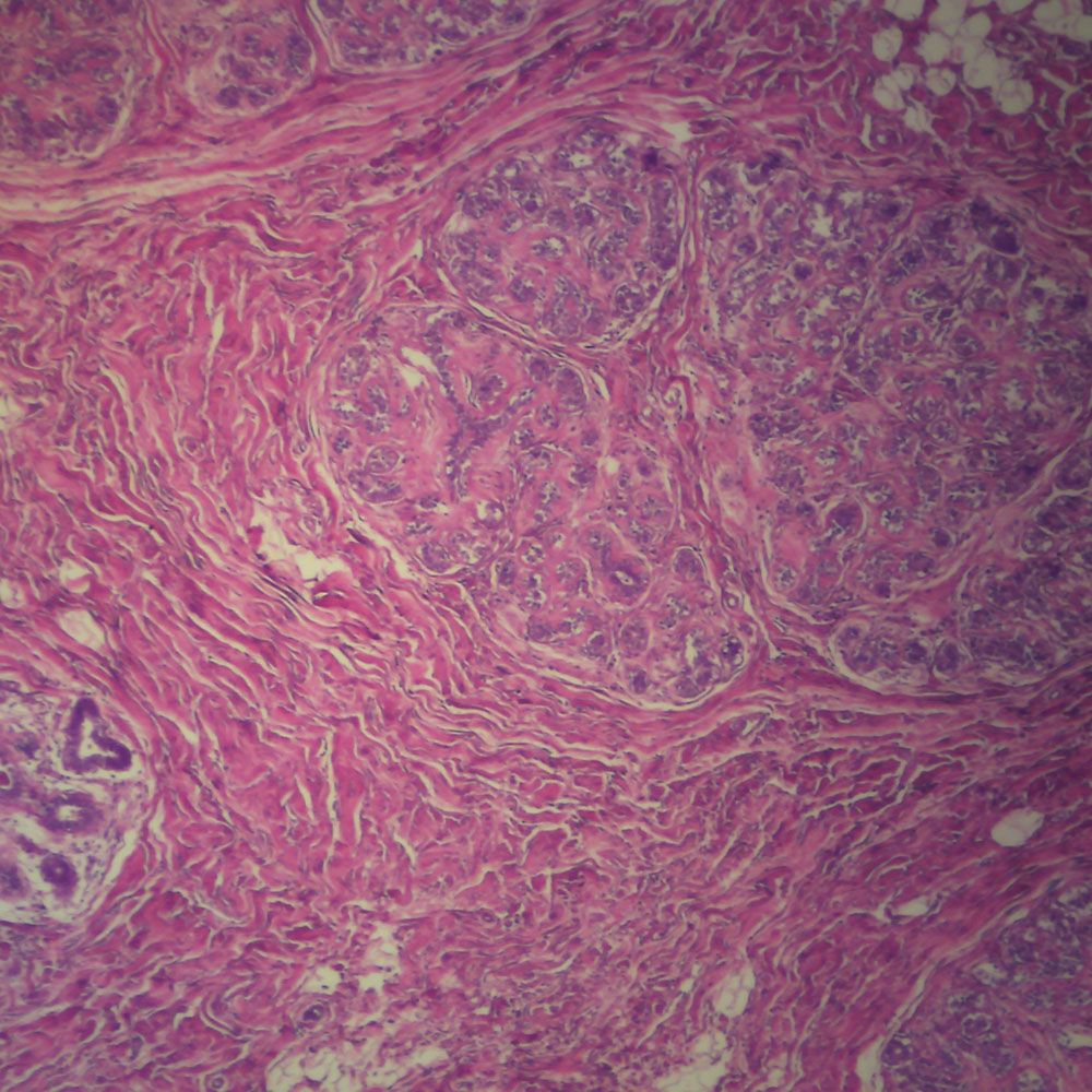 Prepared Microscope Slide, Human Breast, Normal Mammary Gland, Resting ...
